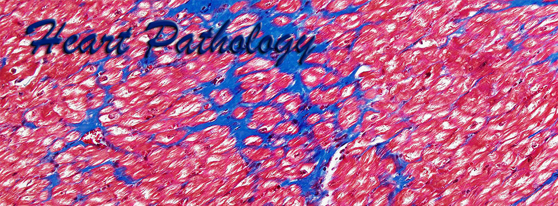 Heart Pathology